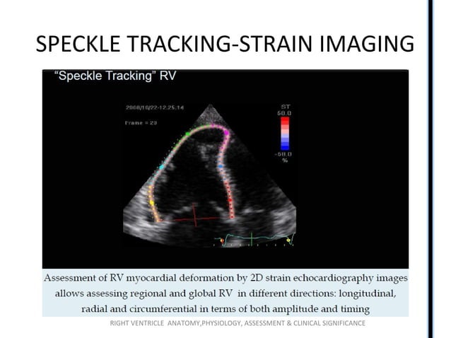Right ventricle (RV) anatomy and functions