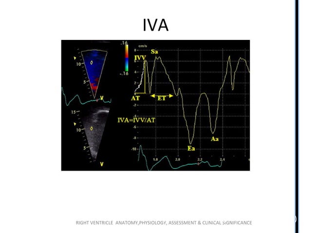 Right ventricle (RV) anatomy and functions
