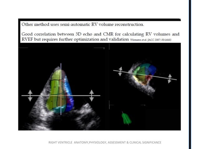Right ventricle (RV) anatomy and functions