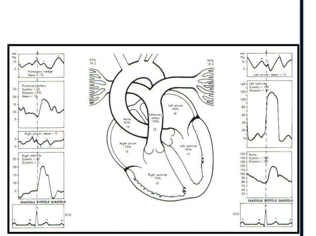 Right ventricle (RV) anatomy and functions