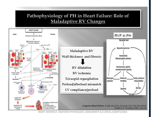 Right ventricle (RV) anatomy and functions