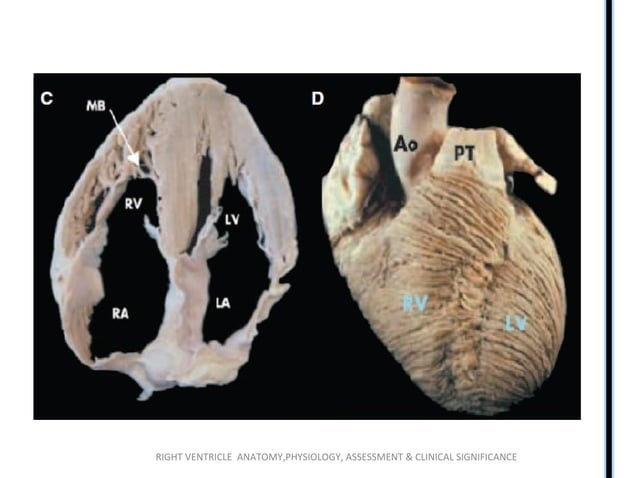 Right ventricle (RV) anatomy and functions