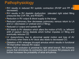 Right ventricular infarction | PPTX