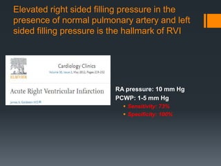 Right ventricular infarction | PPTX