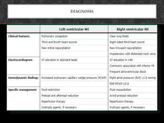Right ventricular infarction | PPTX