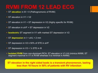 Right ventricular infarction | PPTX