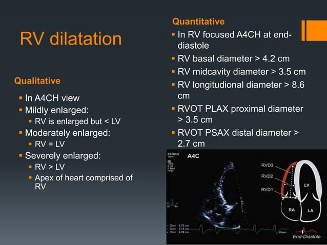 Right ventricular infarction | PPTX