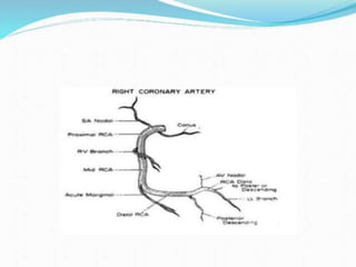 Right ventricular infarction | PPTX