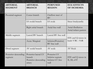 Right ventricular infarction | PPTX