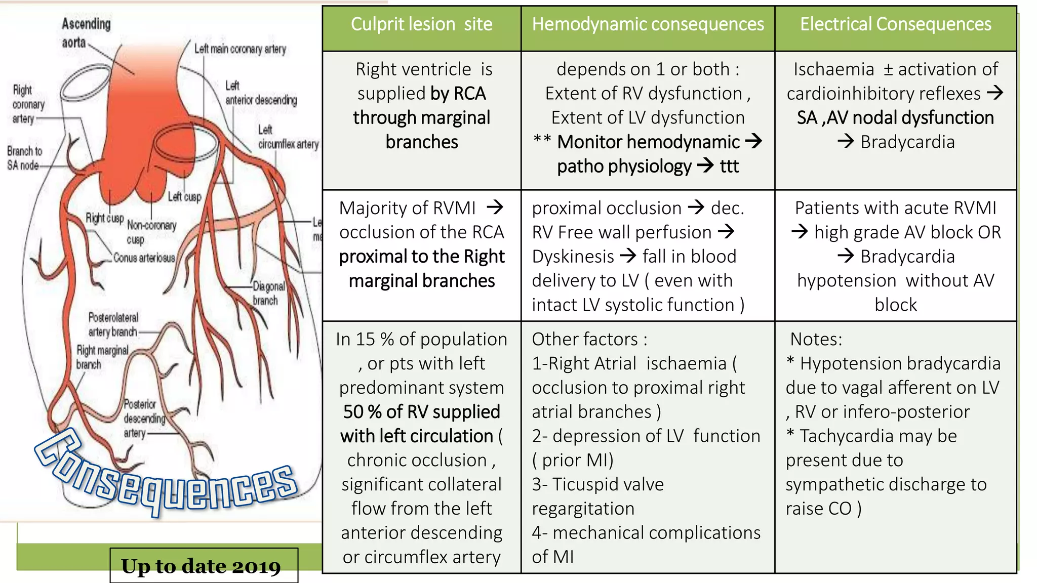 Right ventricular MI | PPT