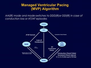 Right ventricular pacing revisited | PPT