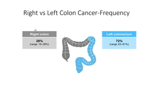 Left Vs Right Colon Cancer | Left Sided Colorectal Cancer – QGWR
