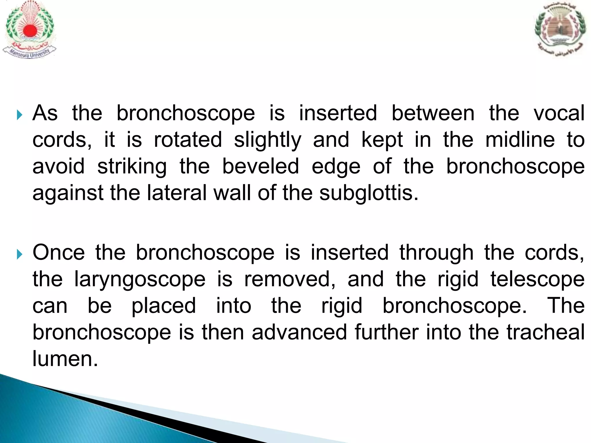 Rigid bronchoscopy | PPTX