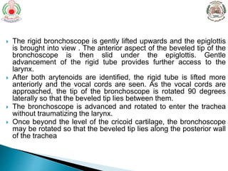 Rigid bronchoscopy | PPTX