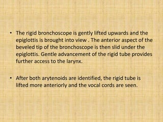 Rigid bronchoscopy | PPTX