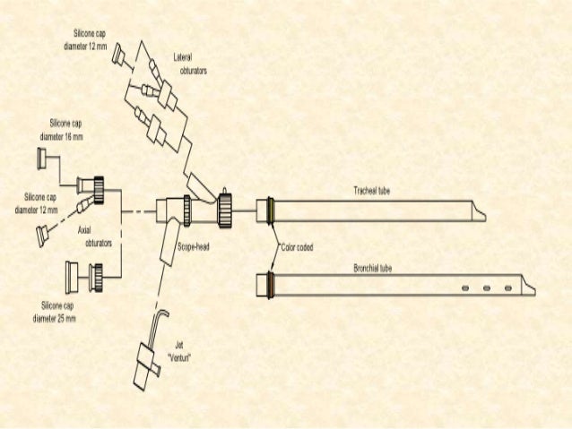 Rigid bronchoscopy