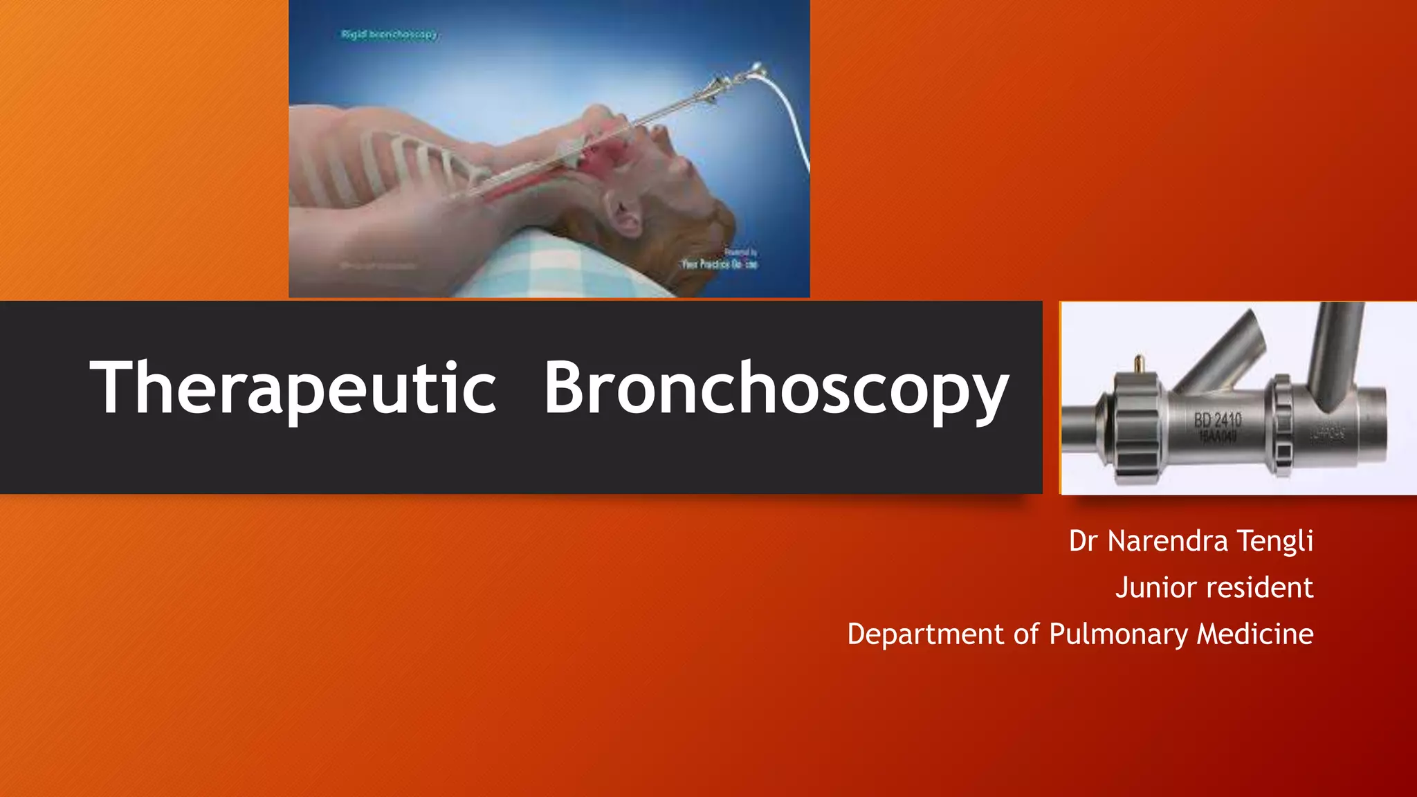 Rigid bronchoscopy- interventional bronchoscopy | PPTX