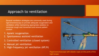 Rigid bronchoscopy- interventional bronchoscopy | PPTX