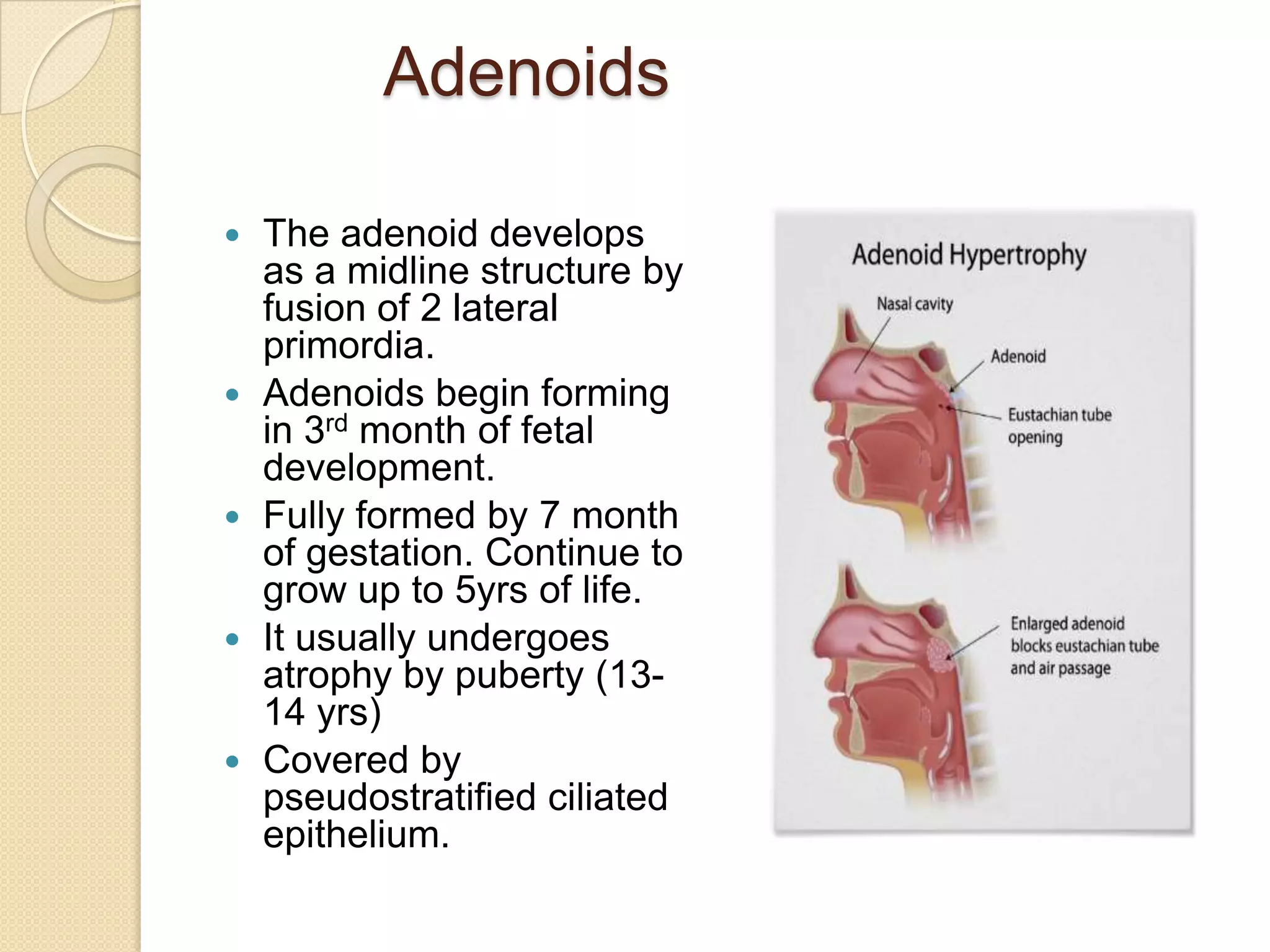 ADENOIDS&ADENOIDECTOMY BY ROOHIA | PPT