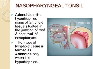 ADENOIDS&ADENOIDECTOMY BY ROOHIA | PPT
