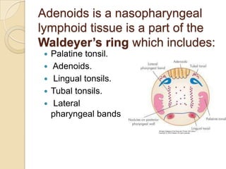 ADENOIDS&ADENOIDECTOMY BY ROOHIA | PPTX