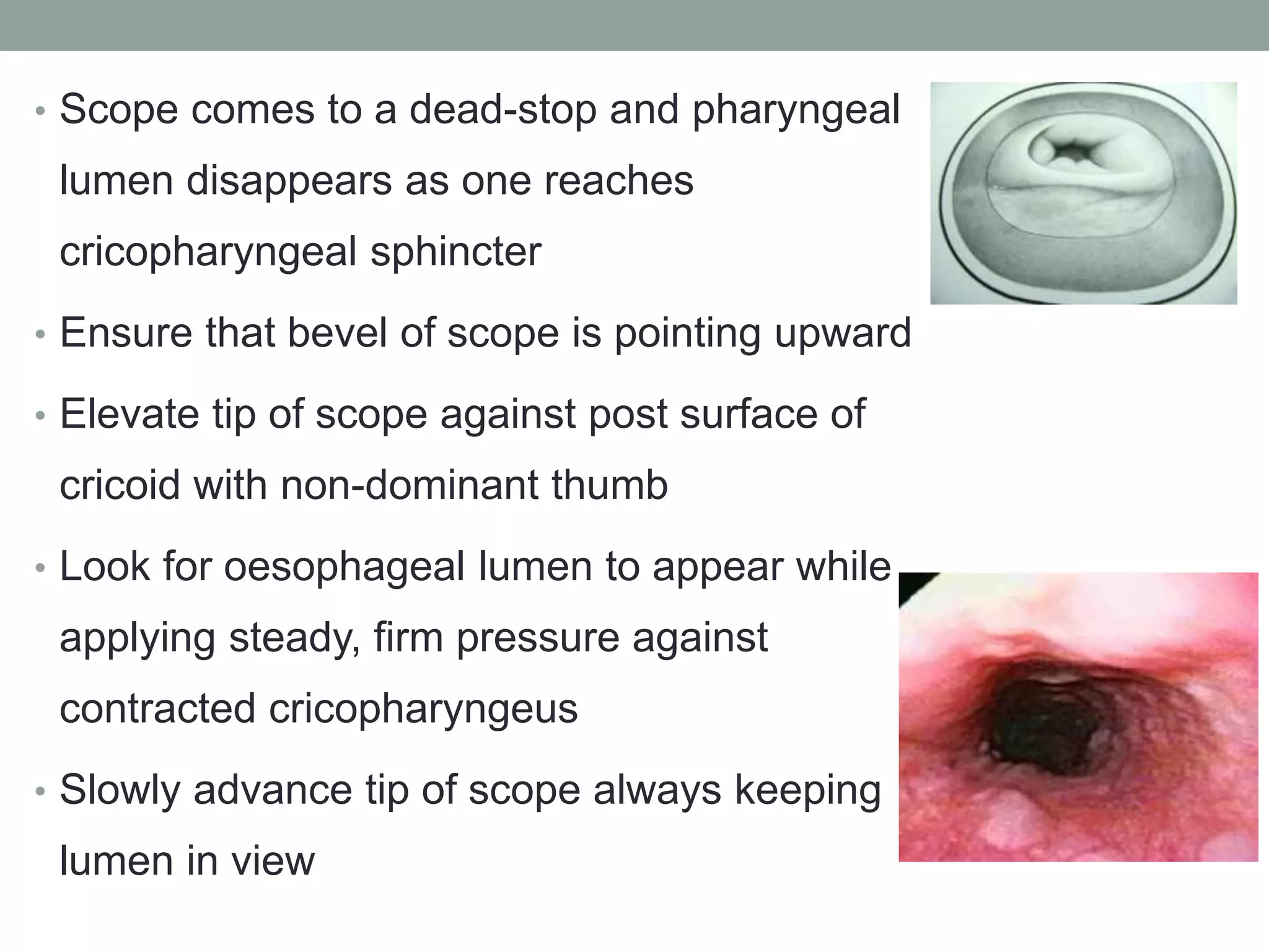 Rigid endoscopies | PPTX