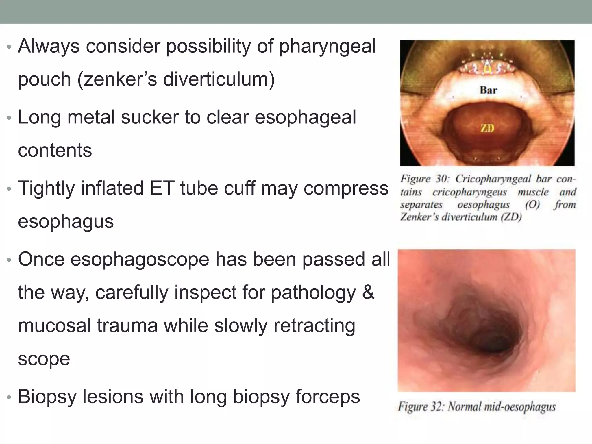 Rigid endoscopies | PPTX