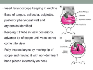 Rigid endoscopies | PPTX