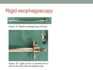 Rigid Esophagoscopy
