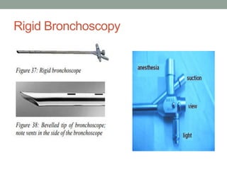 Rigid Bronchoscope Parts