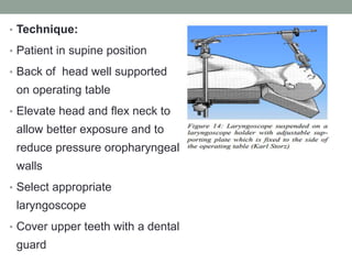 Rigid Esophagoscopy