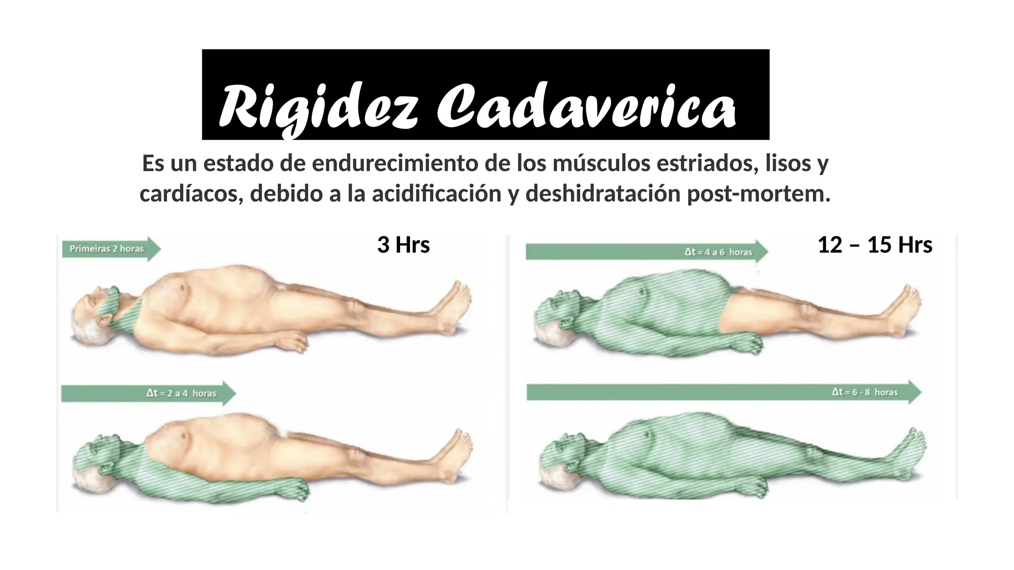 Rigidez Cadaverica_20250203_175246_0000.pptx