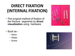 RIGID INTERNAL.pptx