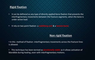 Rigid internal fixation | PPTX