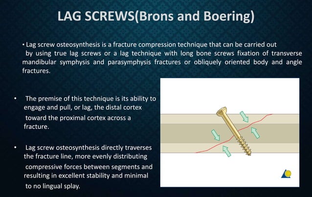 Rigid internal fixation | PPTX