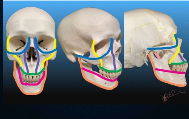 Rigid internal fixation | PPTX