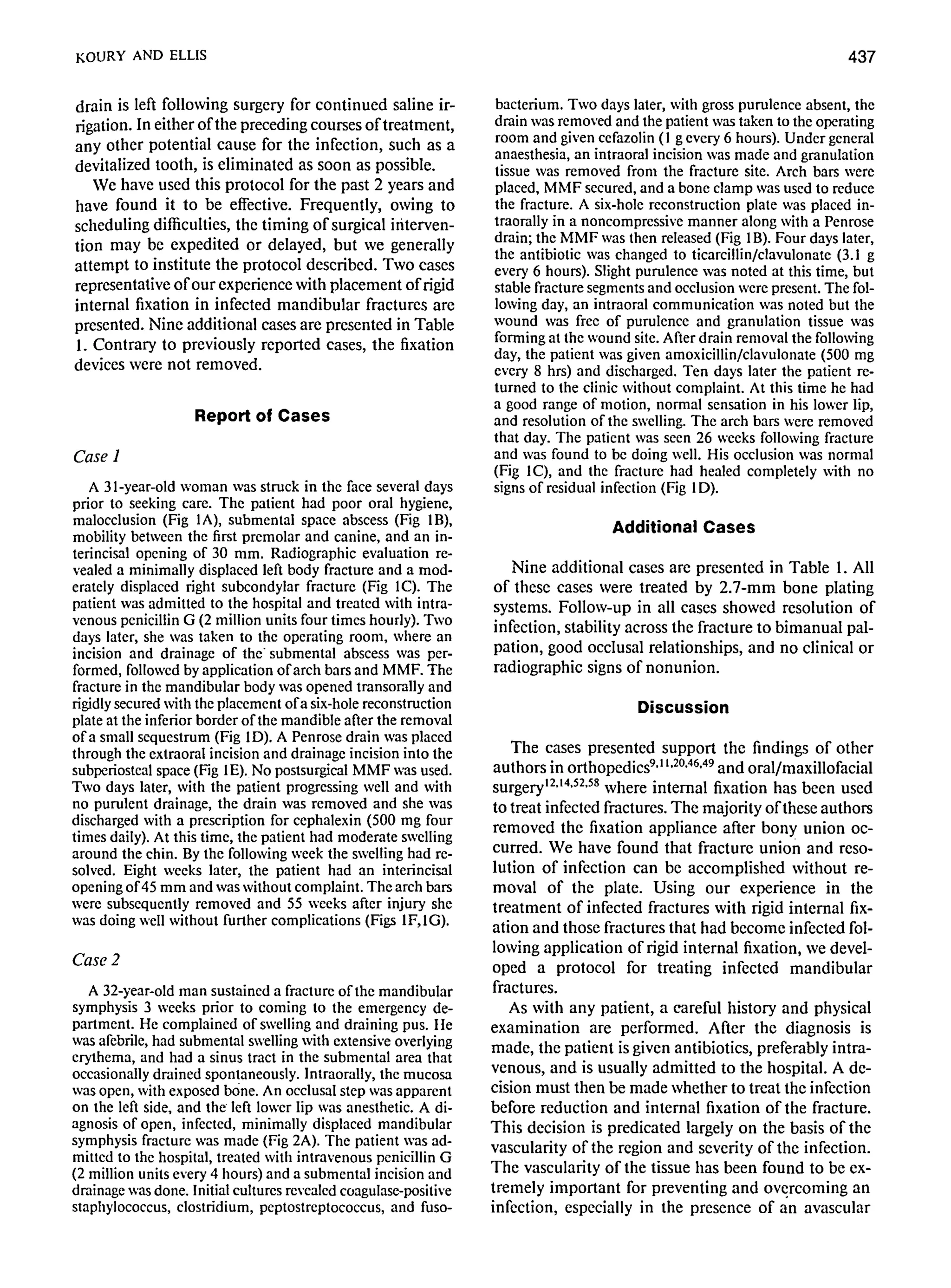Rigid internal fixation for mandibular of infected mandibular fractures ...