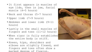 Rigor mortis definition description andm | PPTX