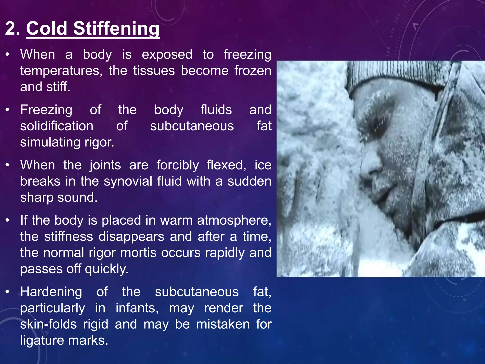 Rigor mortis ppt | PPTX