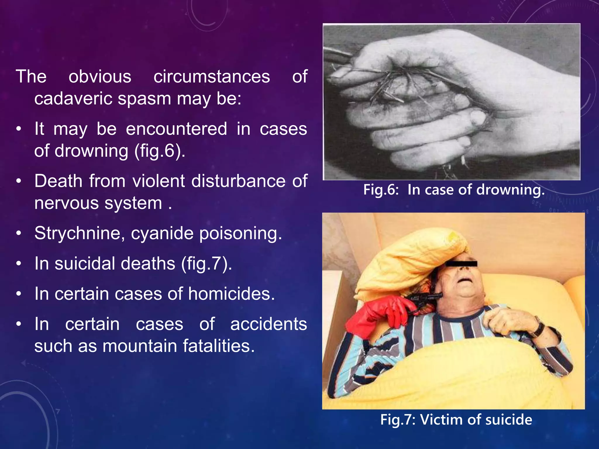 Rigor mortis ppt | PPTX