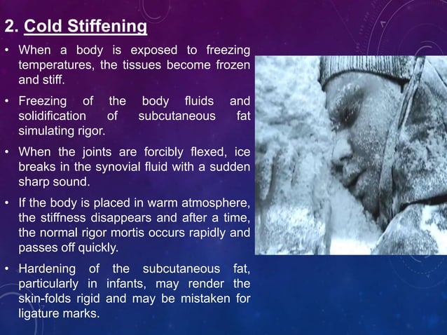 Rigor mortis ppt | PPTX