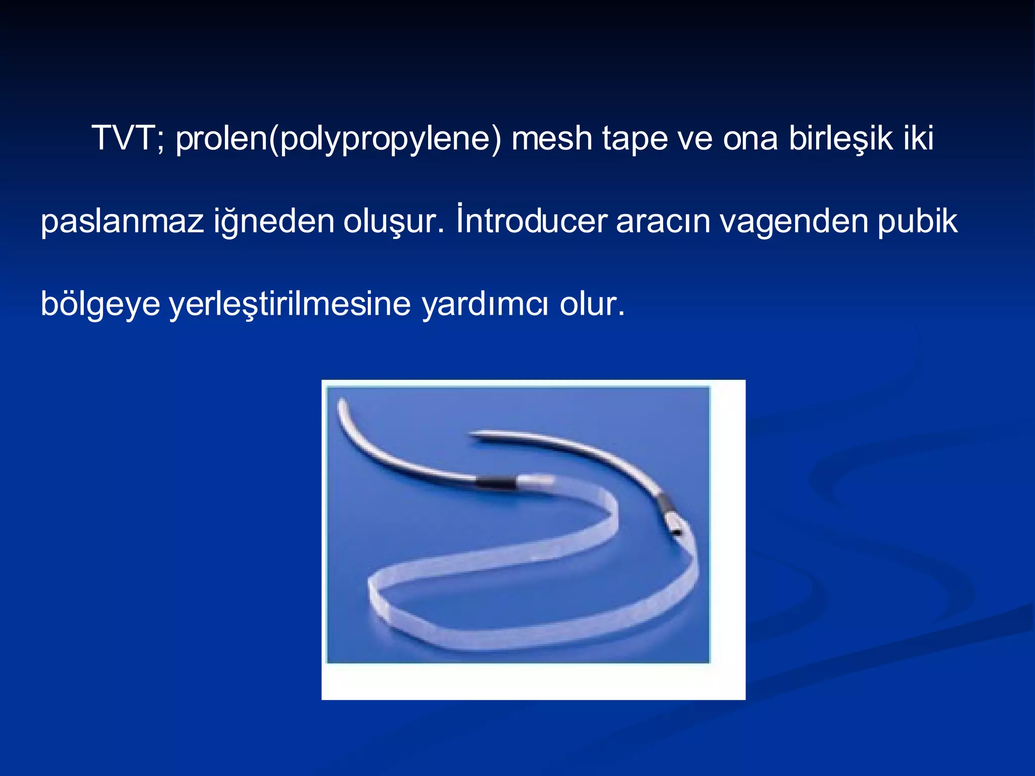 Üriner İnkontinansta Sling (Askı) Operasyonları - www ...