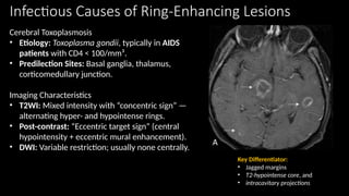 Ring-Enhancing Lesions Differentiation with MRI.pptx