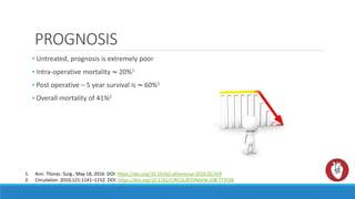 Paravalvular abscess in infective endocarditis | PPTX | Heart and ...