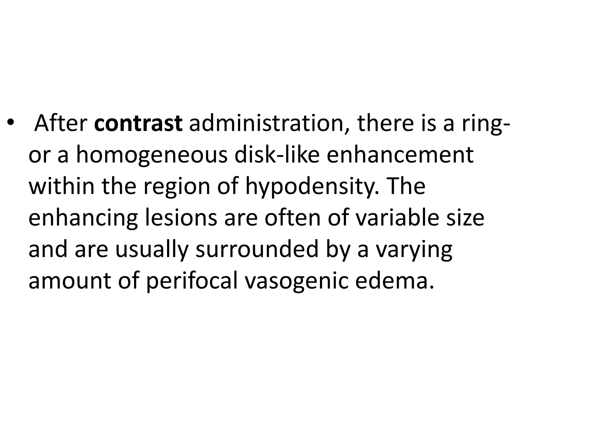 Ring enhancing lesions | PPTX