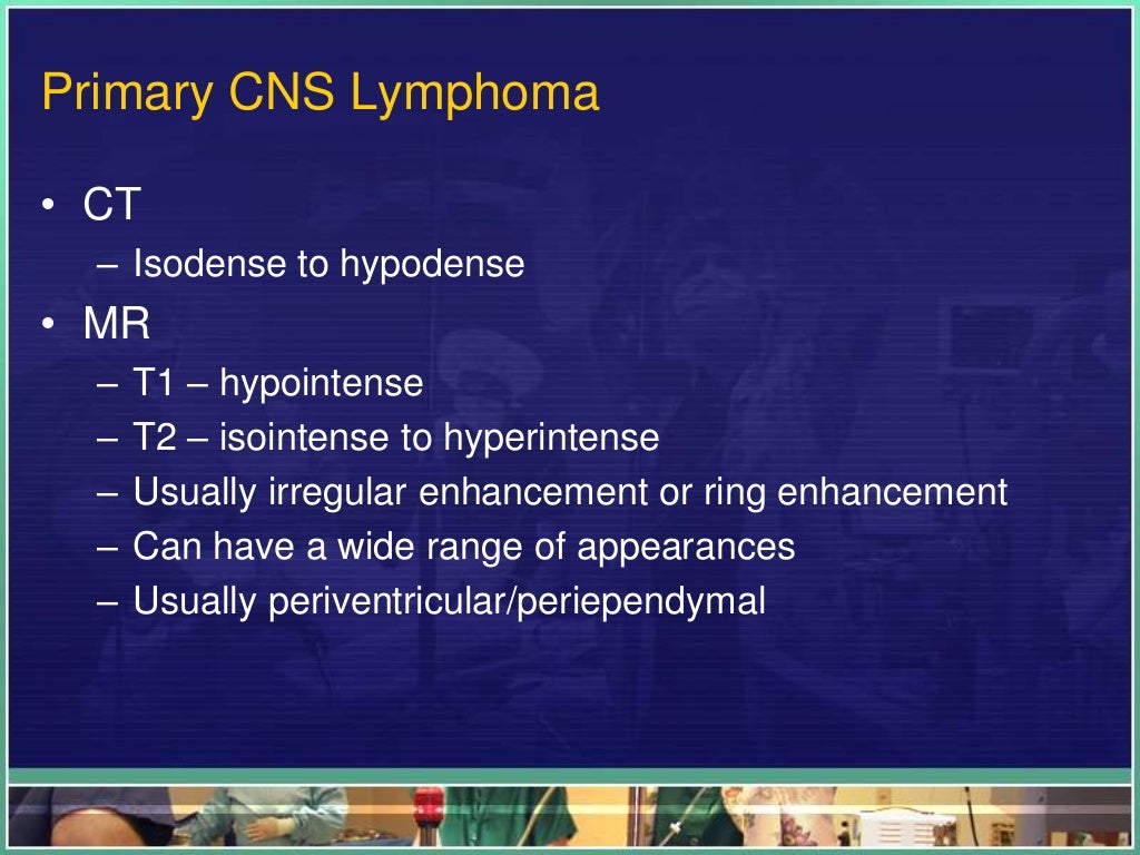 Ring enhancing lesions usmle - lasoparev