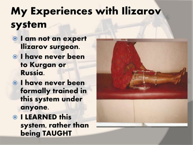 My Experiences with Ilizarov system | PPT