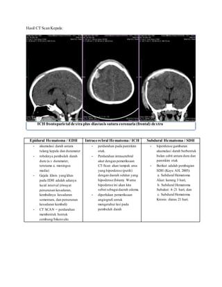 Ringkasan skenario 1 | PDF
