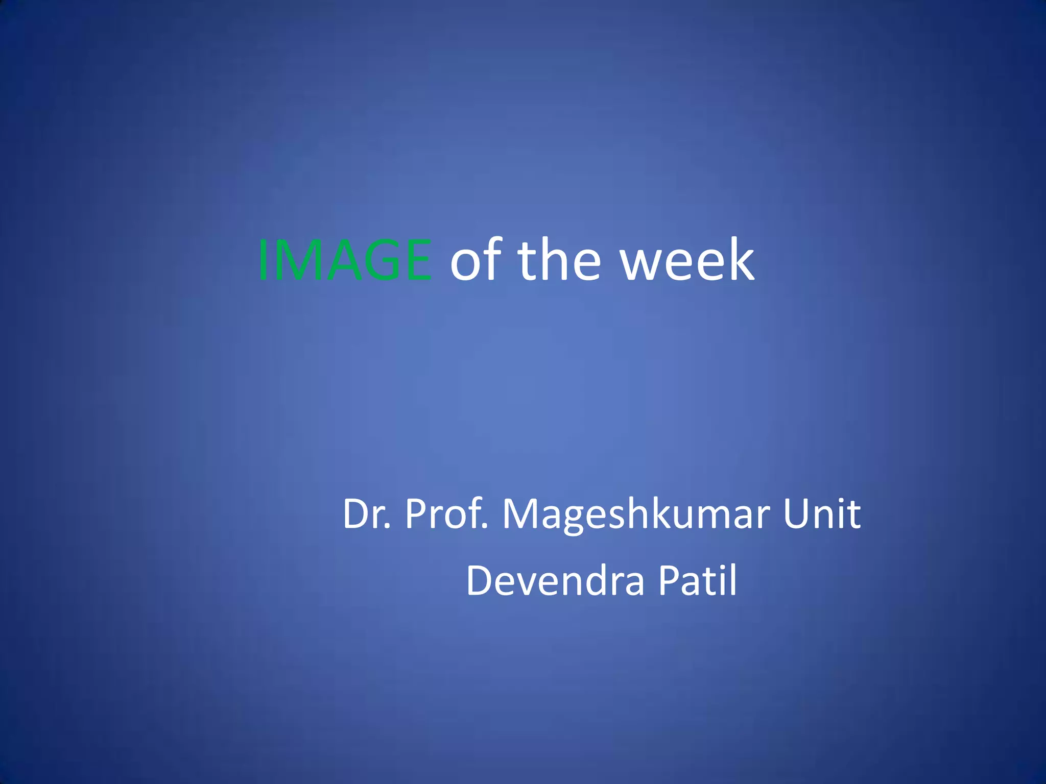 CT - Ring Enhancing Lesion | PPTX