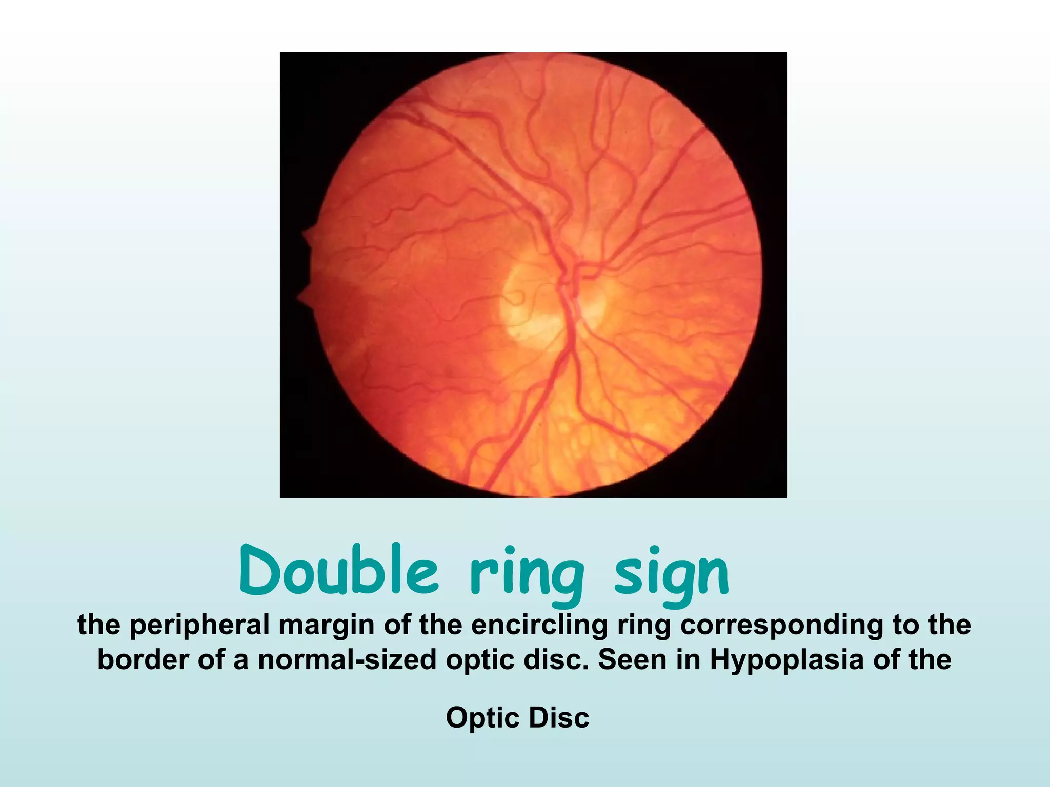 Rings Dots Lines Spots Ppt
